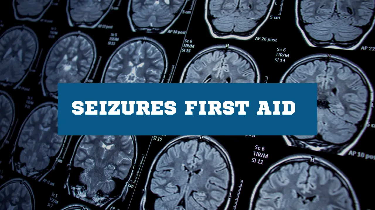 Seizure First Aid: Causes, Symptoms, and Treatment Explained